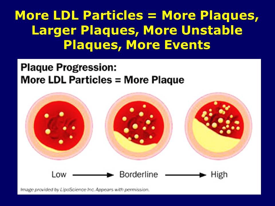 More LDL Particles, More Plaques | Advanced Cholesterol Clinic | RdeGoma